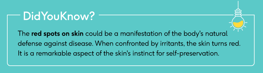 Red Spots on Skin: Meaning, Causes, and Remedies - HK Vitals